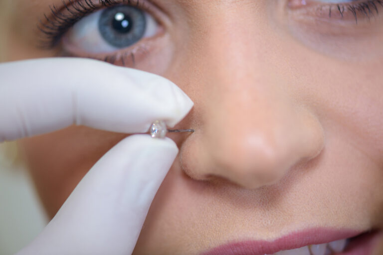 How To Deal With An Infected Nose Piercing